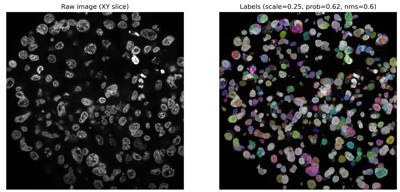 Using StarDist 3D Demo Model for Embryo Nucleus Segmentation ...