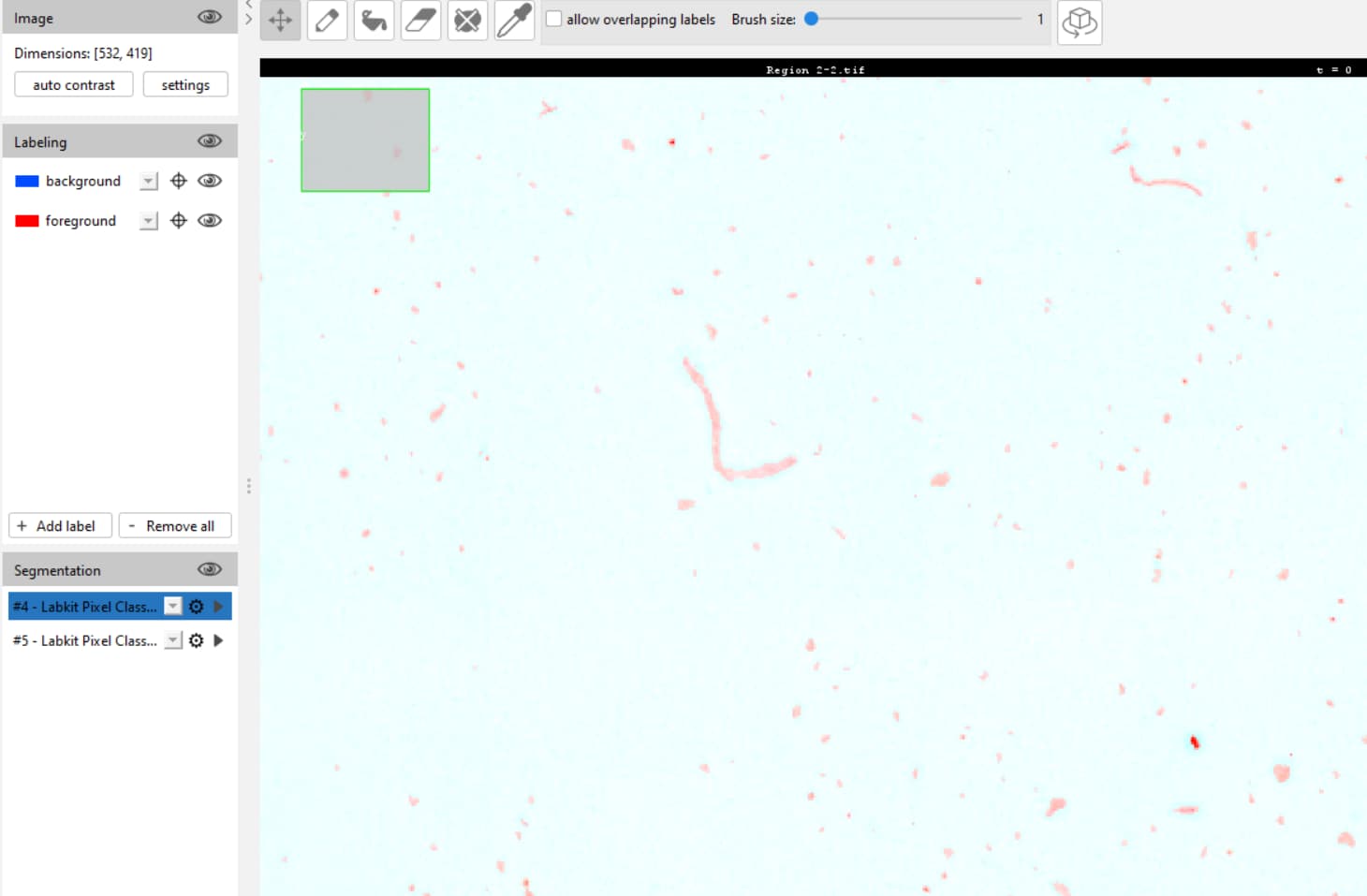 Detecting of fibers - Image Analysis - Image.sc Forum