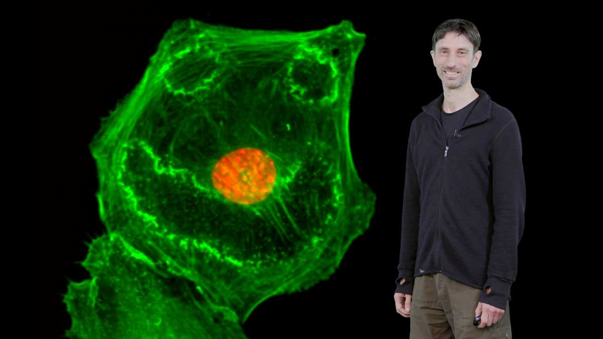 Help with creating and using masks in ImageJ - Image Analysis - Image ...