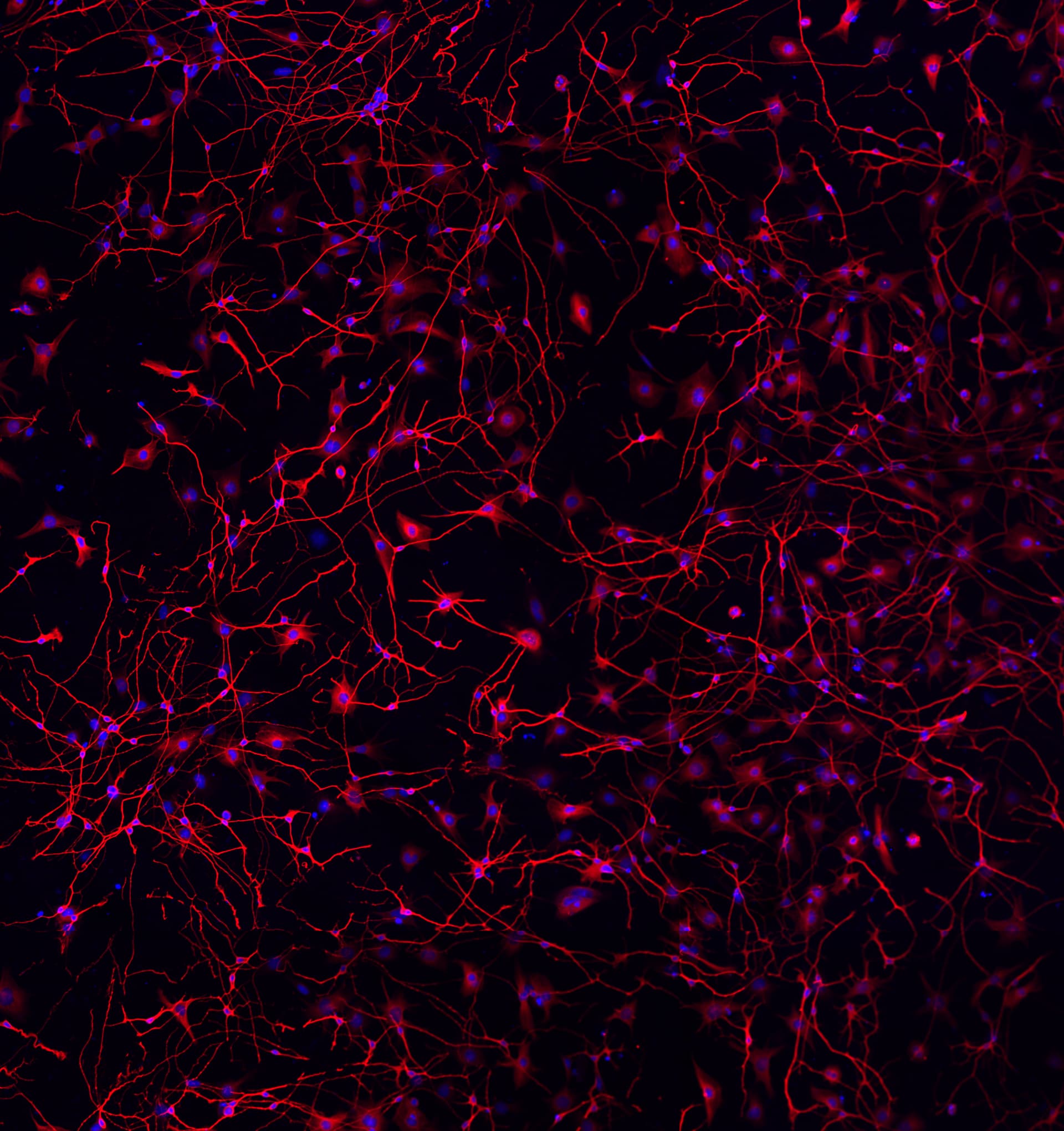 Segmenting neurons and other cells - Image Analysis - Image.sc Forum