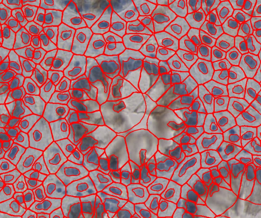 Train Object Classifier To Detect Colon Crypts As A Whole Instead Of
