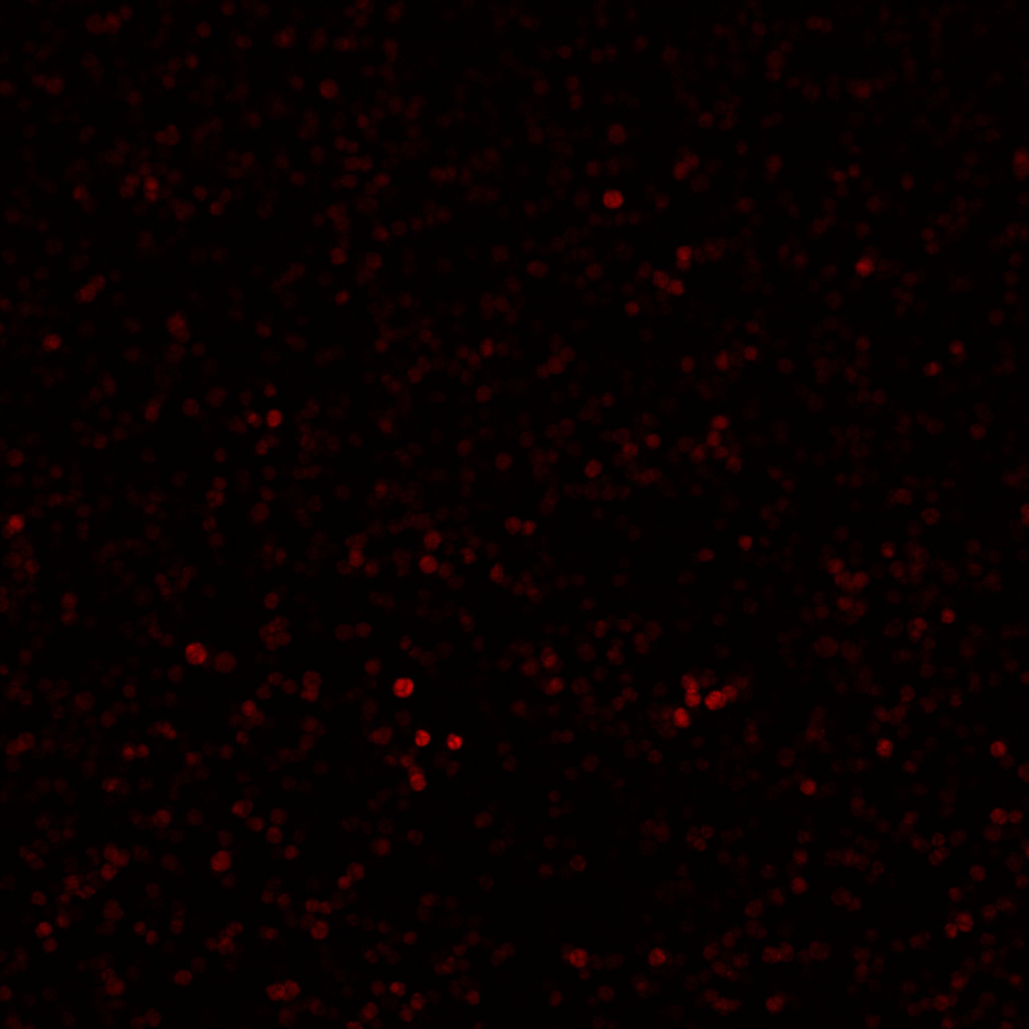 Counting different colors in Cell profiler - Image Analysis - Image.sc ...