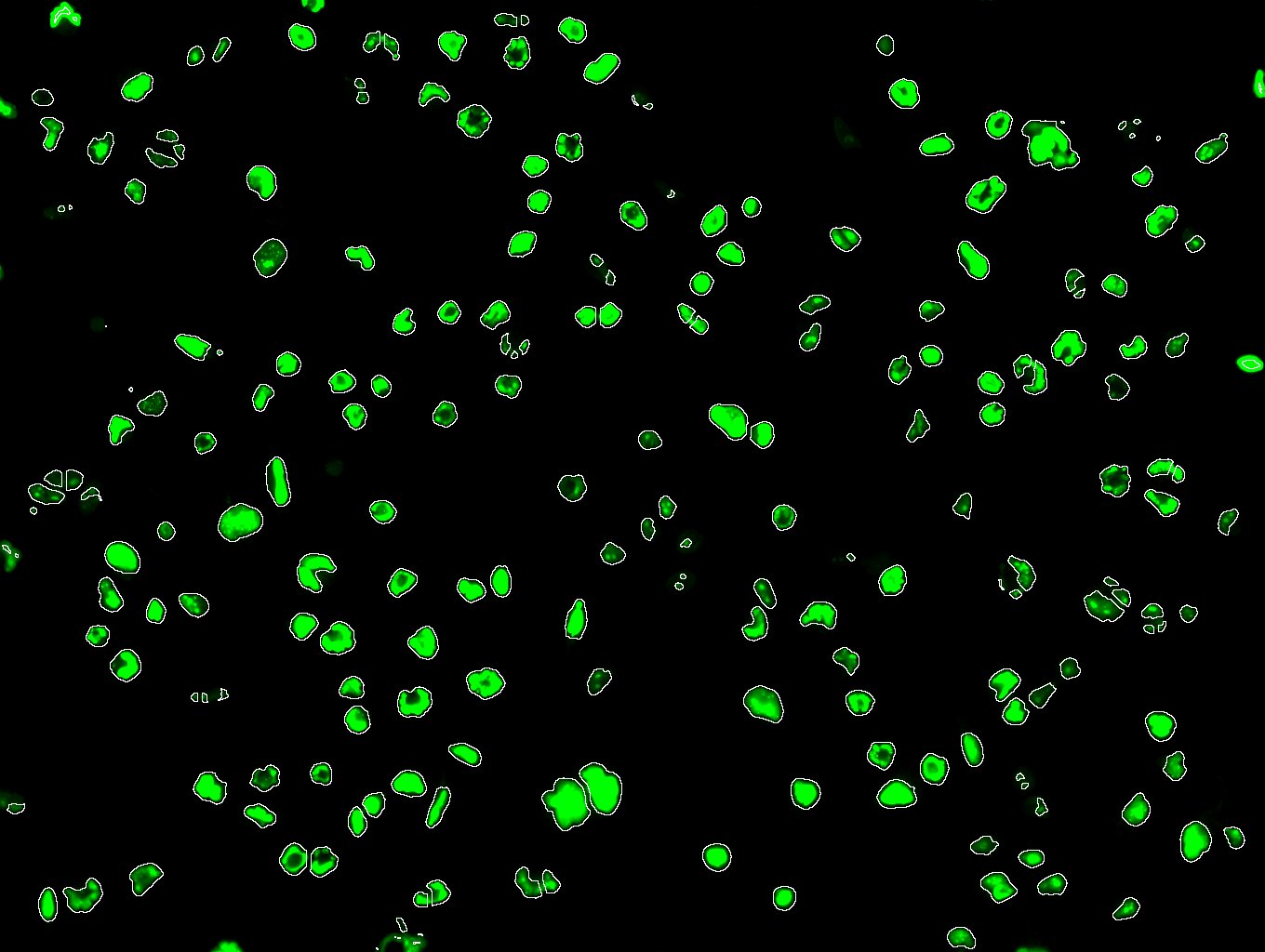 Batch image processing for cell counting - Image Analysis - Image.sc Forum