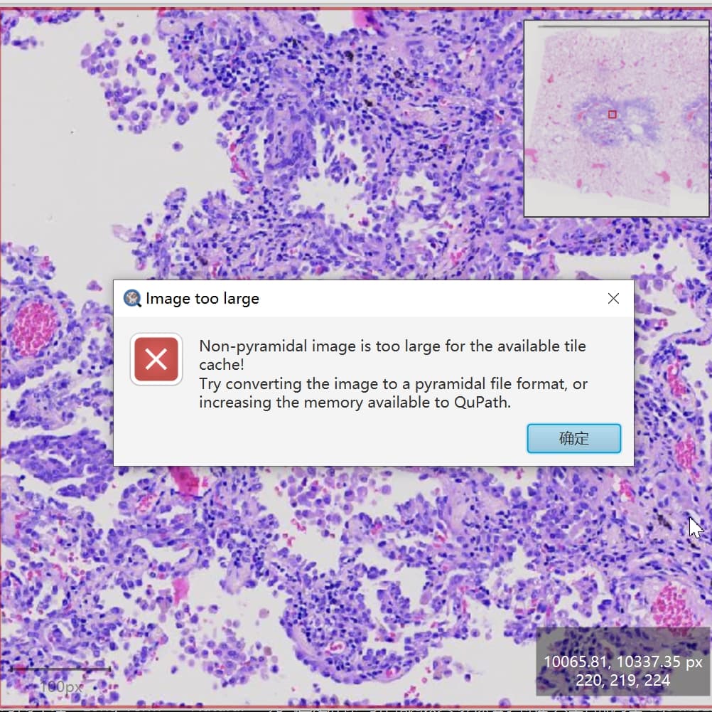 Qupath Cannot open too large TIFF format picture - Usage & Issues - Image.sc Forum