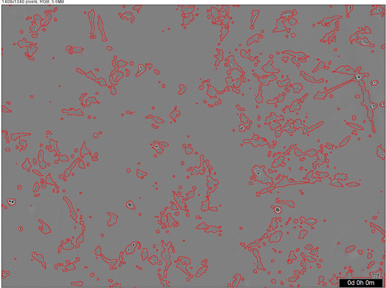 Brightfield Cell counting - Image Analysis - Image.sc Forum