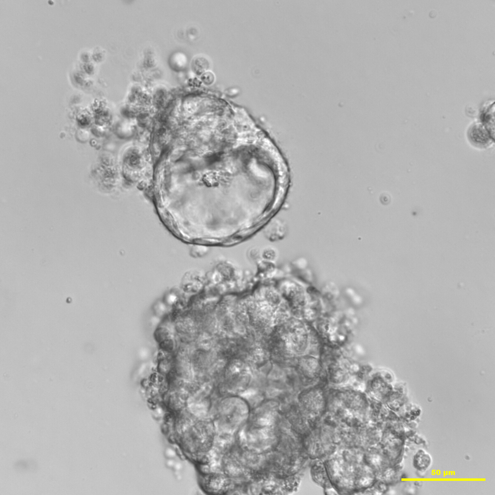 Identifying Two Different Cell Types - Image Analysis - Image.sc Forum