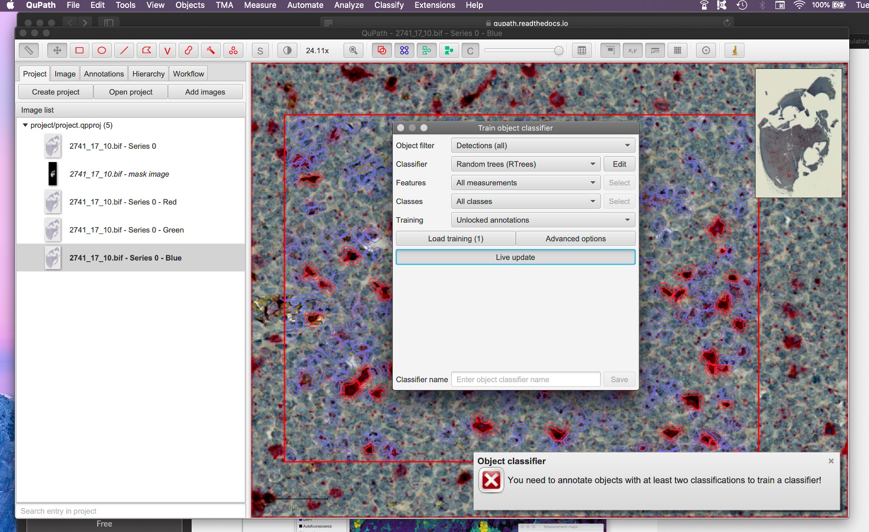 QuPath - multiplexed analysis - Image Analysis - Image.sc Forum