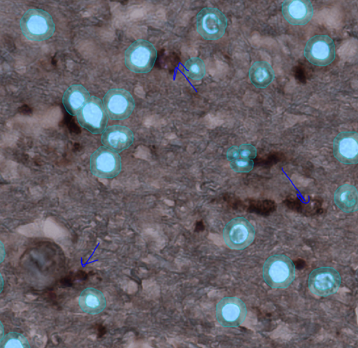 Cell detection with DAB, hematoxylin and DAPI - Image Analysis - Image.sc Forum