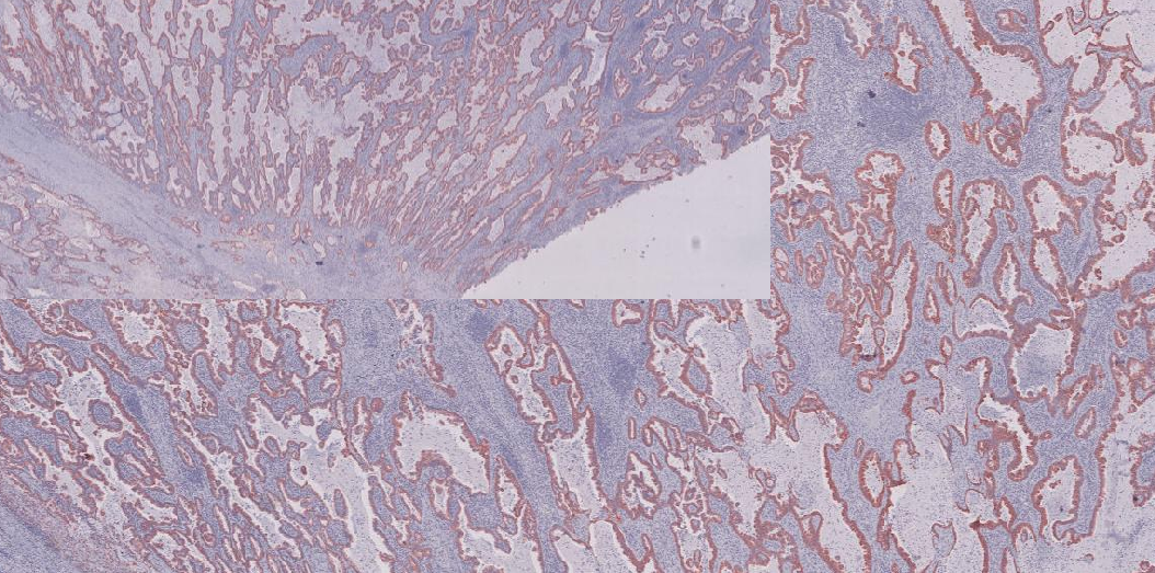 QuPath: script for exporting all annotations in a project + cropping - Usage & Issues - Image.sc ...