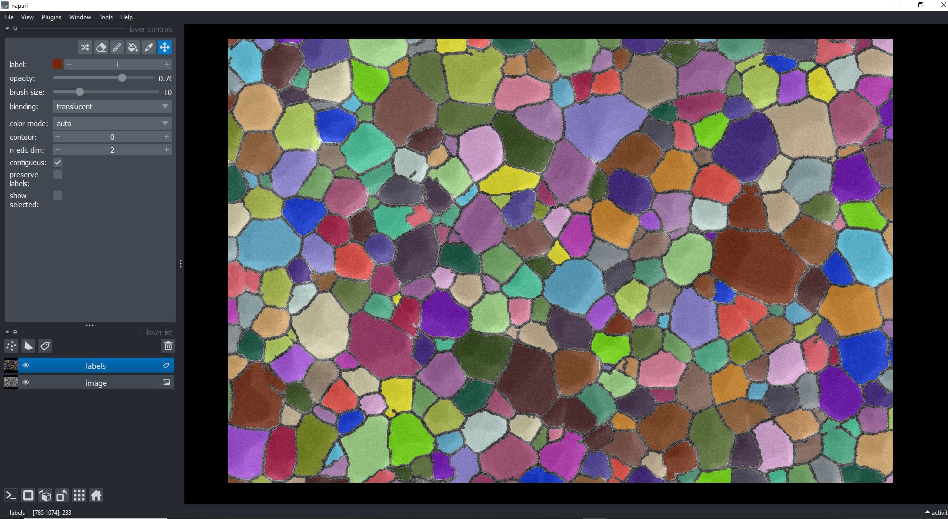 SEM Grain Size Analysis / Edge Detection - Image Analysis - Image.sc Forum