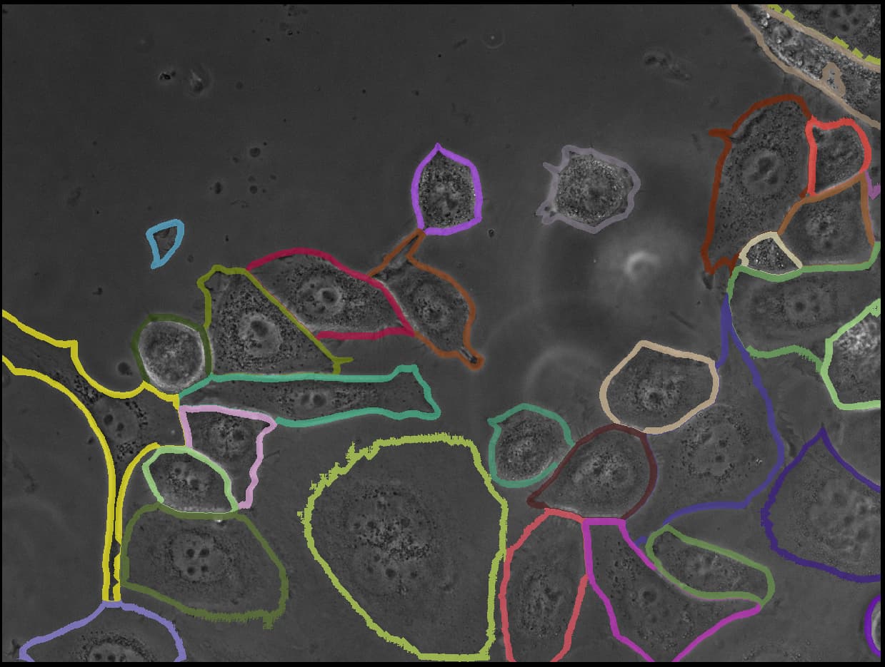 URGENT: Problem with Mask R-CNN training for cell segmentation with Usiigaci, a semi-automated ...