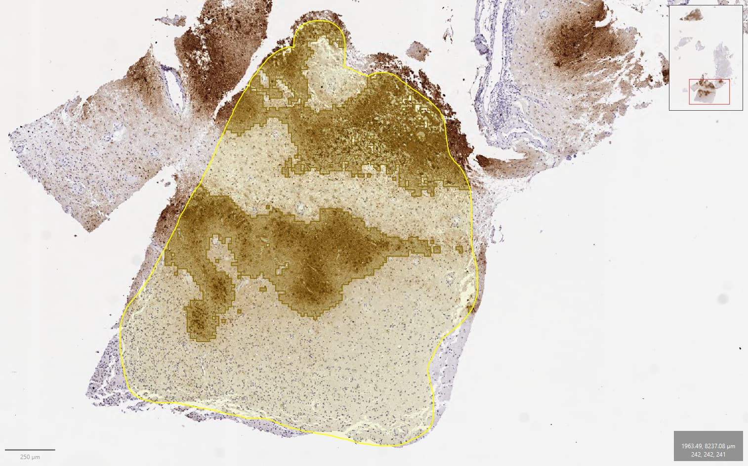 Applying automatic threshold method in QuPath - Image Analysis - Image ...