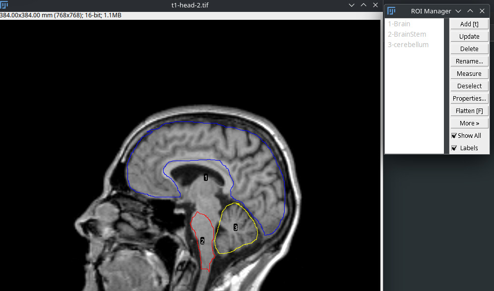 Creating a Multi-Region Mask in a Single File with ImageJ or CellProfiler - Image Analysis ...