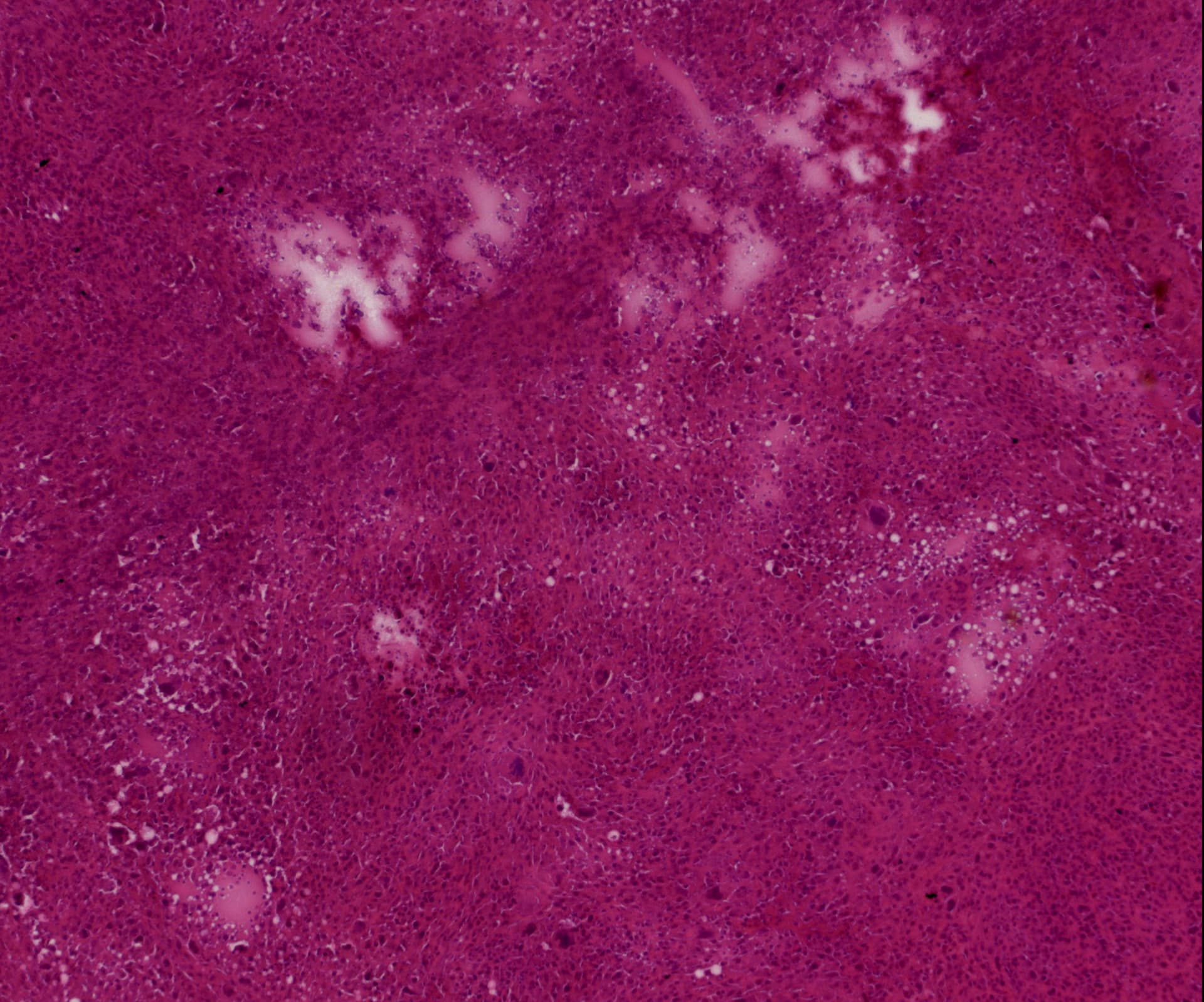 Automated Detection and Analysis of Tissue Holes in Brightfield Microscopy Images using Imagej ...