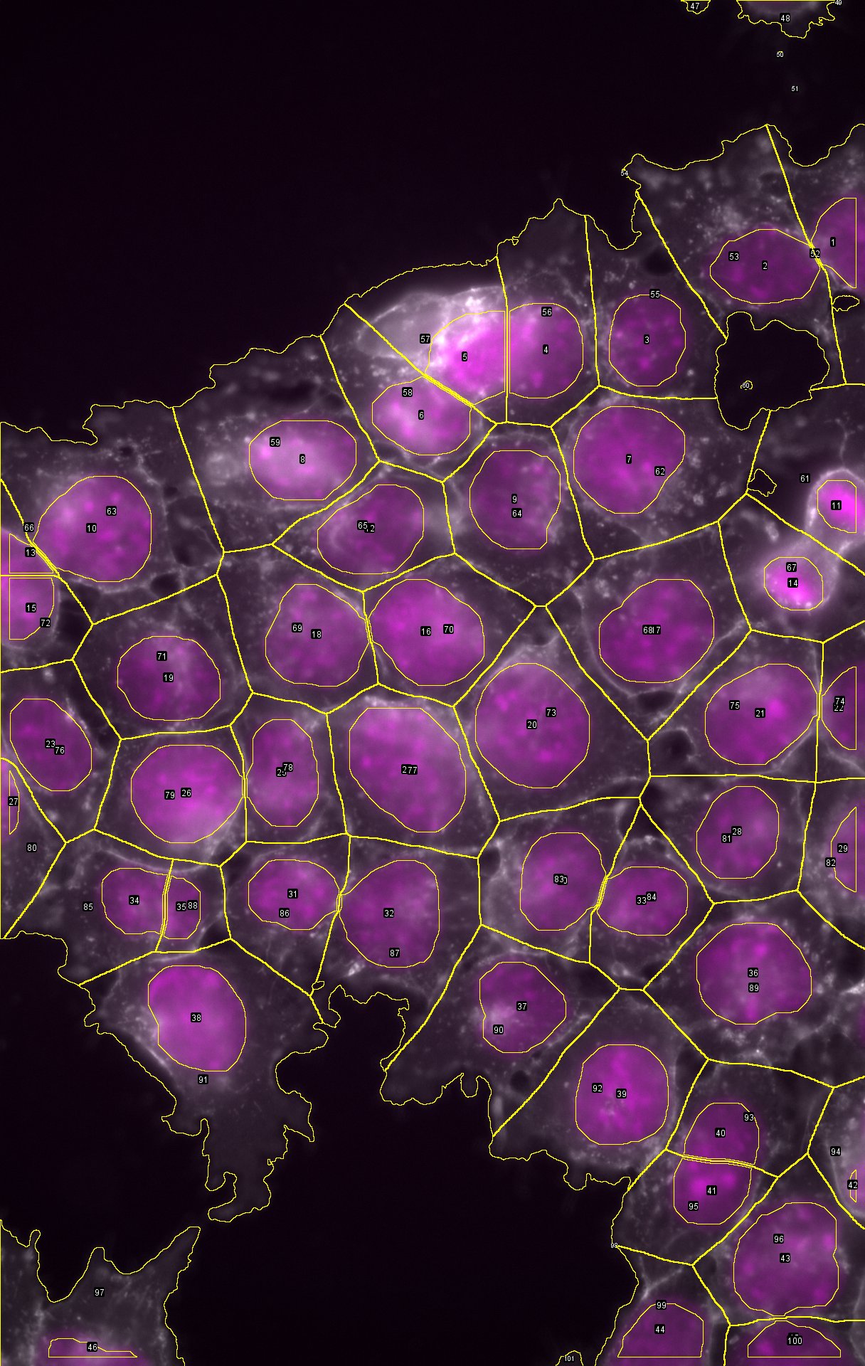 Is there a way to segment cells based on membrane and nuclei ...