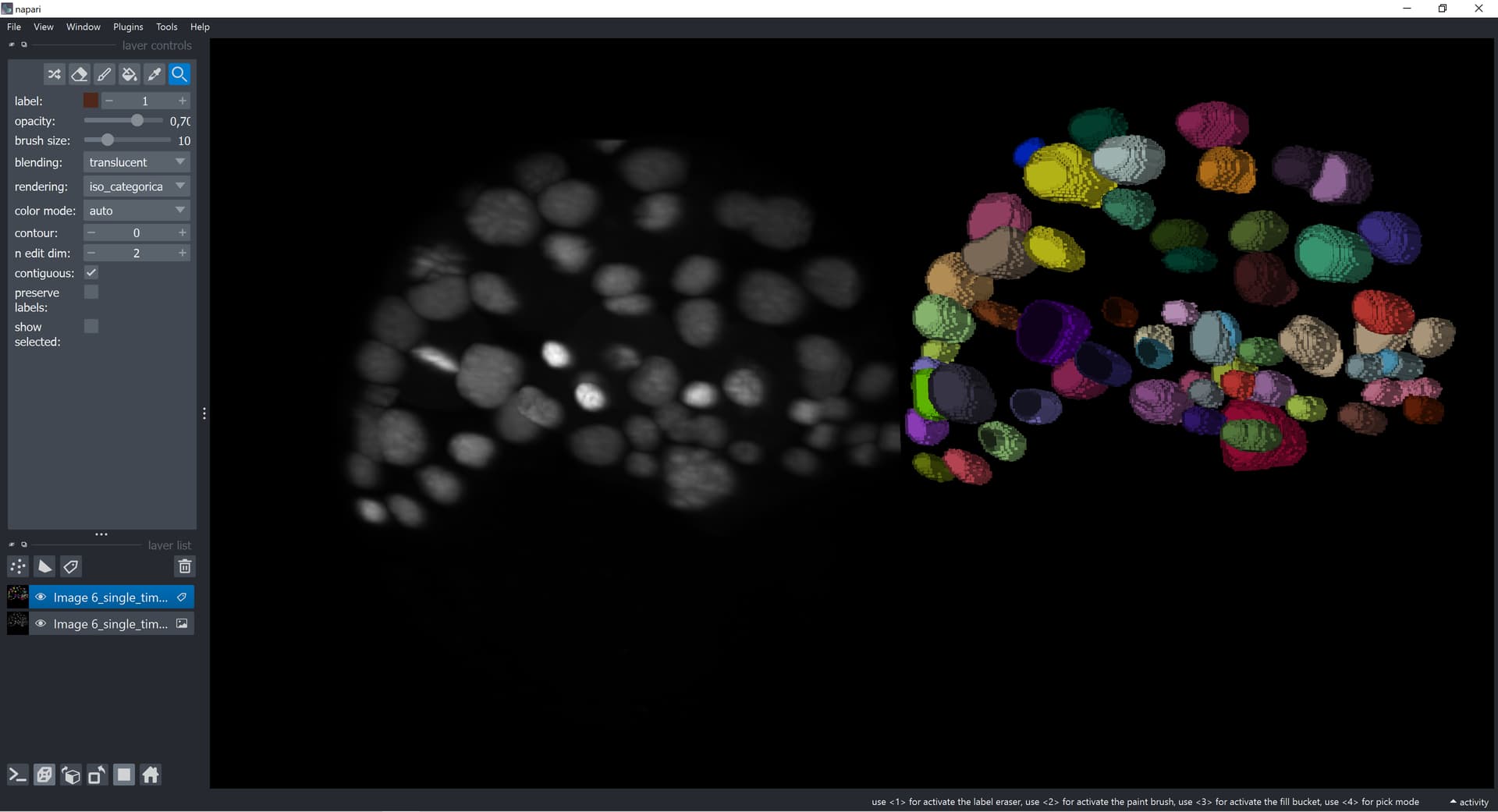 Using pretrained stardist 2D model for training of a stardist 3D model - Image Analysis - Image ...