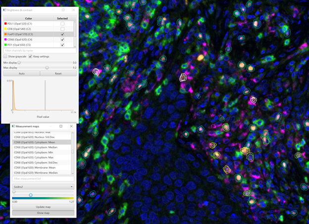 There and back again, QuPath CytoMAP cluster analysis - Image Analysis - Image.sc Forum