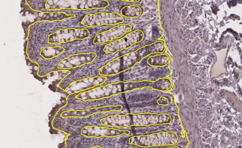 Help: Using CellProfiler for IHC tissue analysis - Image Analysis - Image.sc Forum