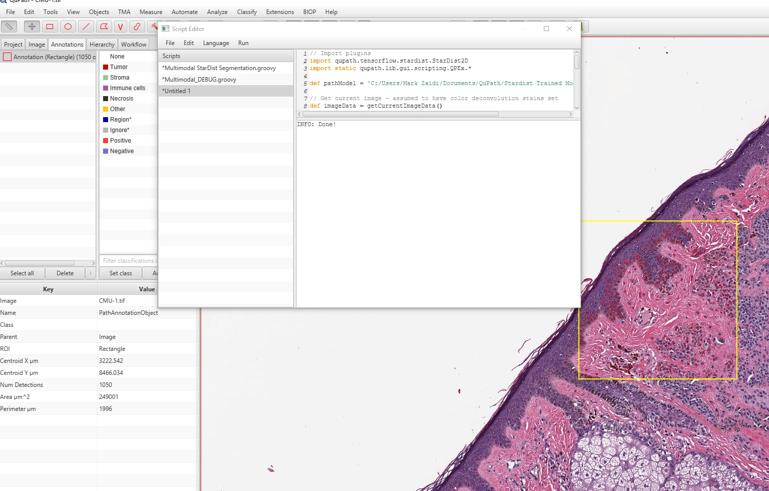 Universal StarDist for QuPath - Transfer Pretrained Models Across Modalities With Ease ...