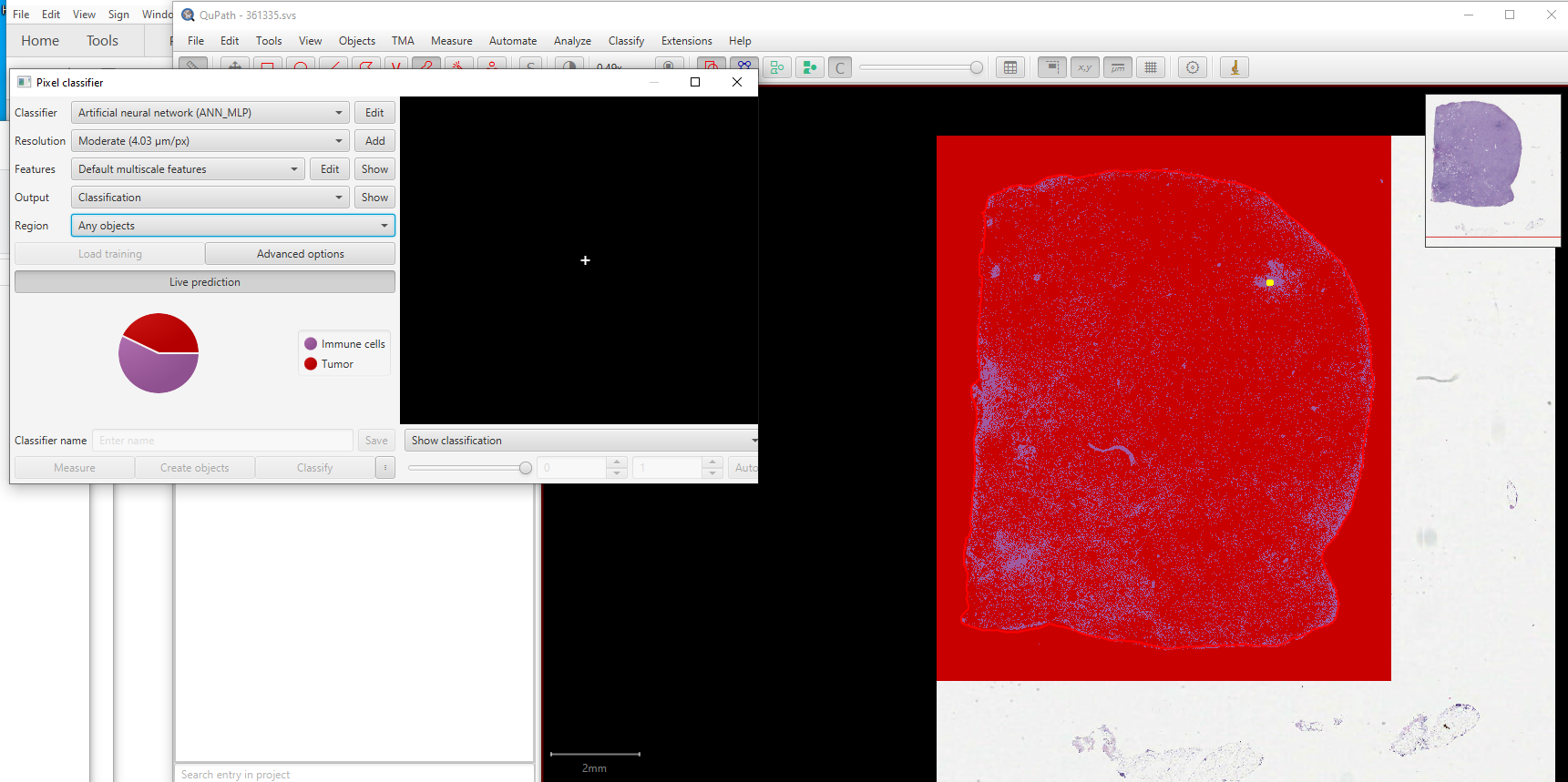 Remove unwanted background for pixel classifier - Image Analysis - Image.sc Forum