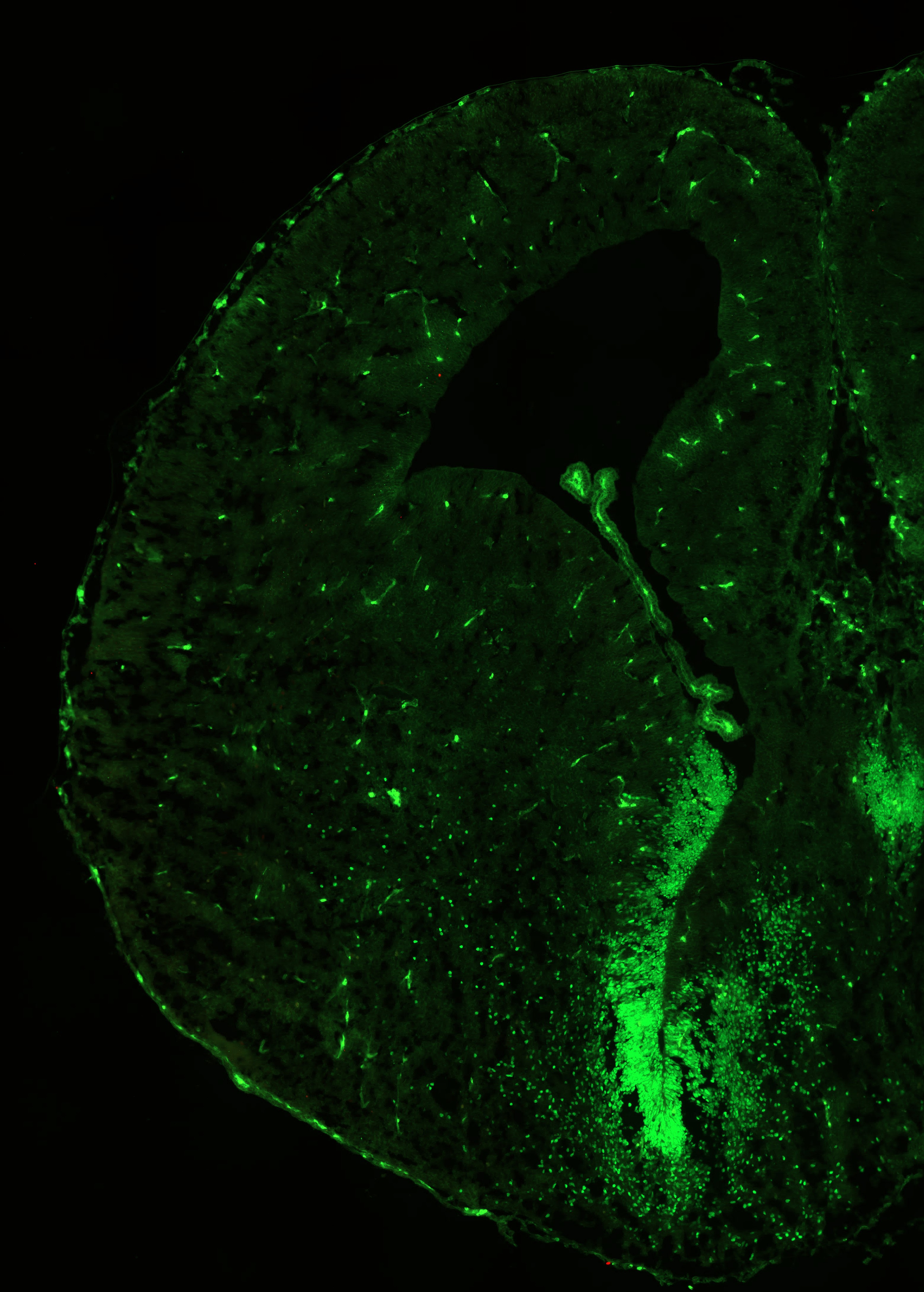 How do I use CellProfiler to specify cells on stained tissue sections ...