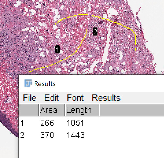 To measure multiple lines of ROI using ImageJ - Image Analysis - Image ...
