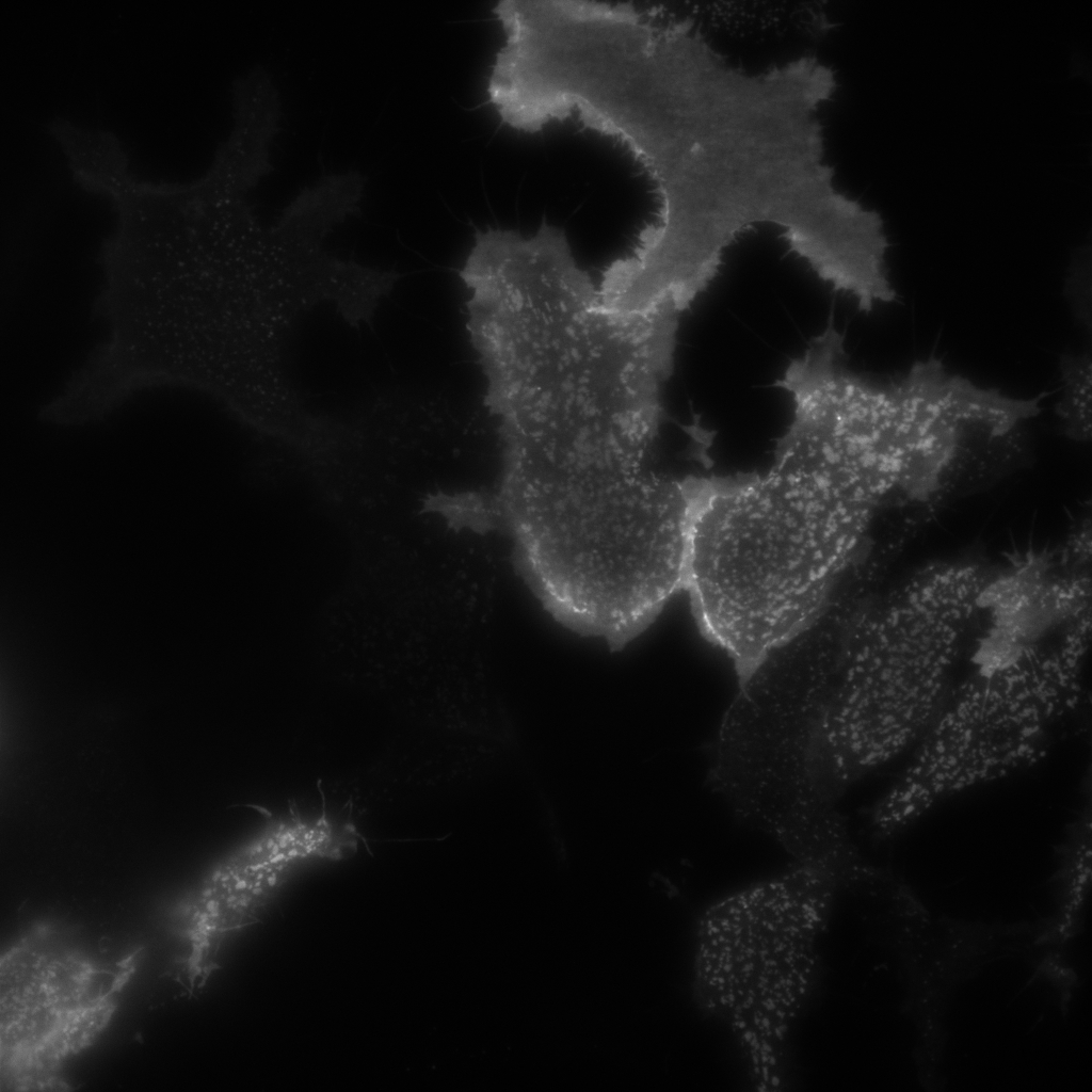 Colocalization analysis using Coloc2-help - Image Analysis - Image.sc Forum