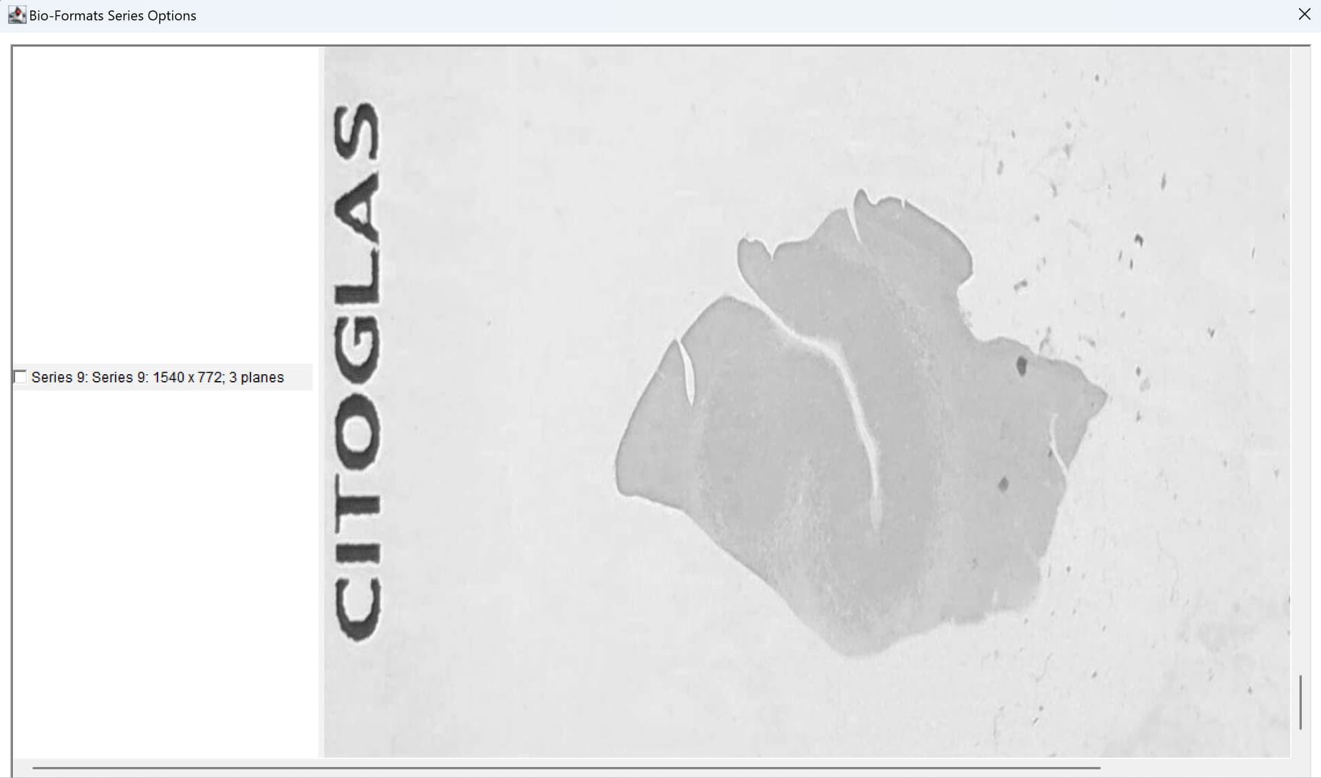 Error when importing pathological slides using the Bio-Formats Importer plugin - Usage & Issues ...