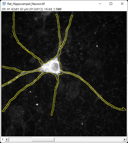 Neuron segmentation - Image Analysis - Image.sc Forum