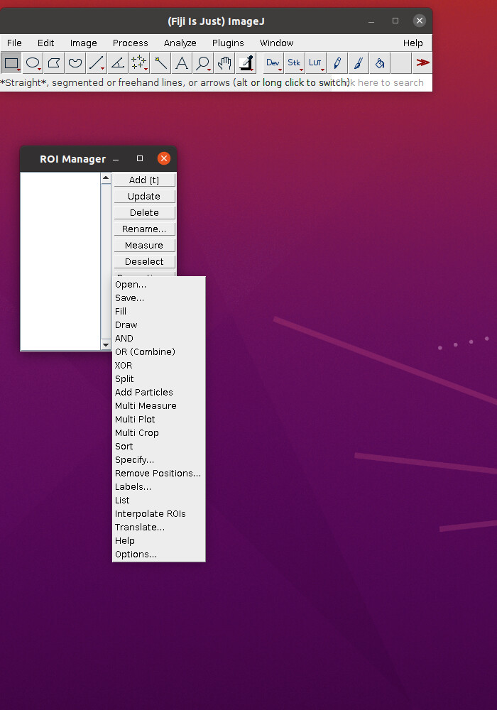 ImageJ/Fiji XOR selection with overlays - Usage & Issues - Image.sc Forum