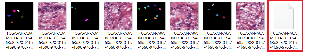 StarDist Cell Classification Training Data Export with custom tileSize ... StarDist Cell Classification Training Data Export with custom tileSize ...