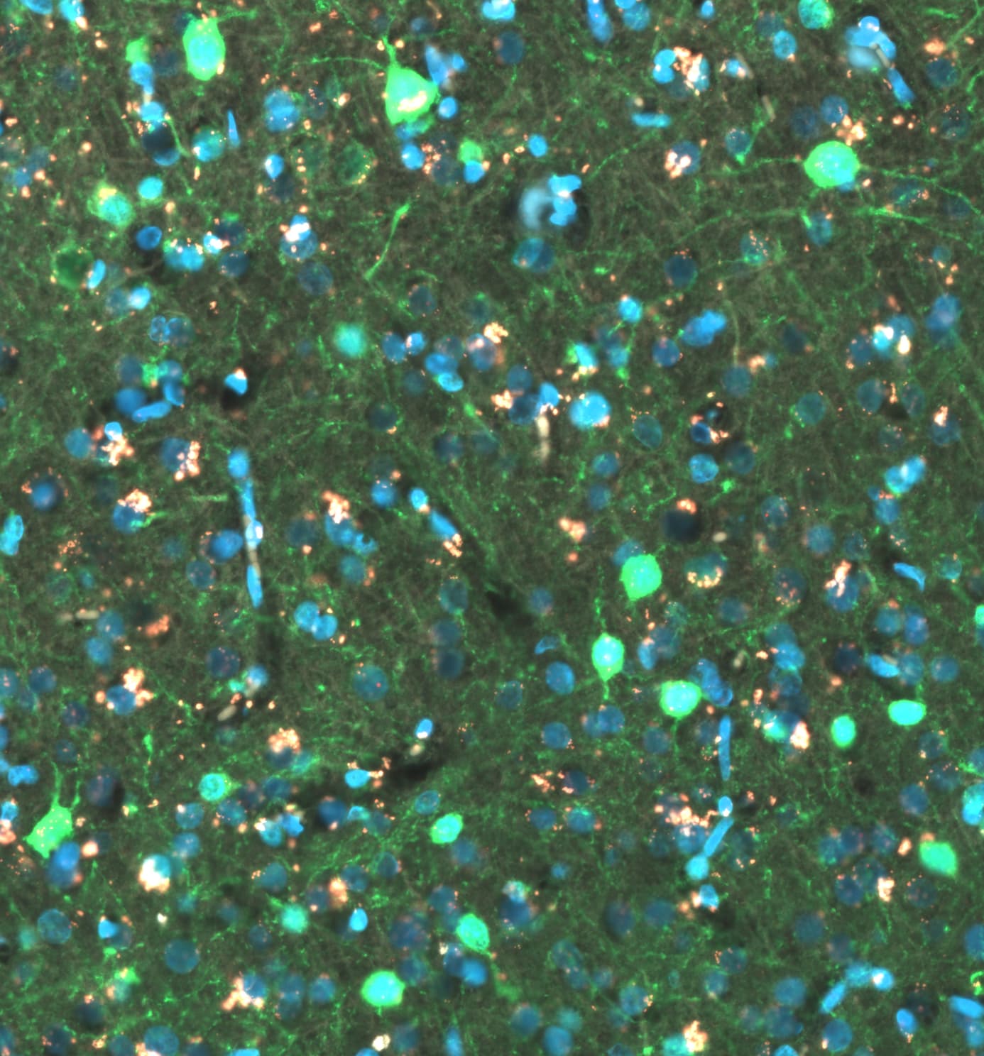 Using qupath for RNAscope IHC colocalization - Image Analysis - Image.sc Forum