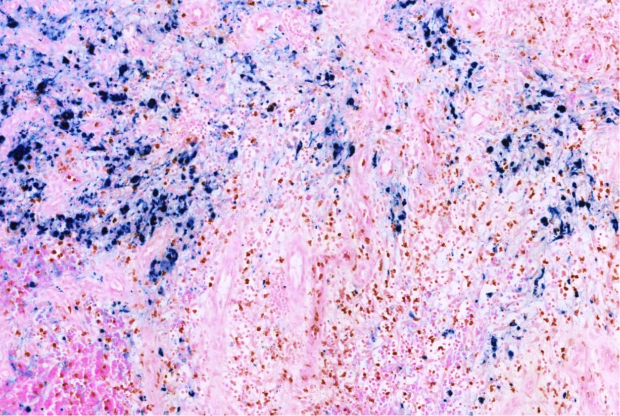 ᴗ•)/ QuPath scripting (#6): Customized 3 stain color deconvolution - Usage & Issues - Image.sc Forum