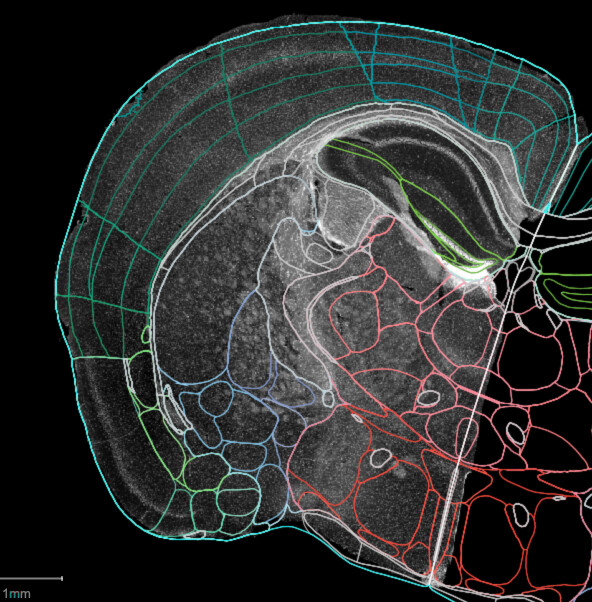 QuPath scripting - annotations deleted when running cell detection - Image Analysis - Image.sc Forum