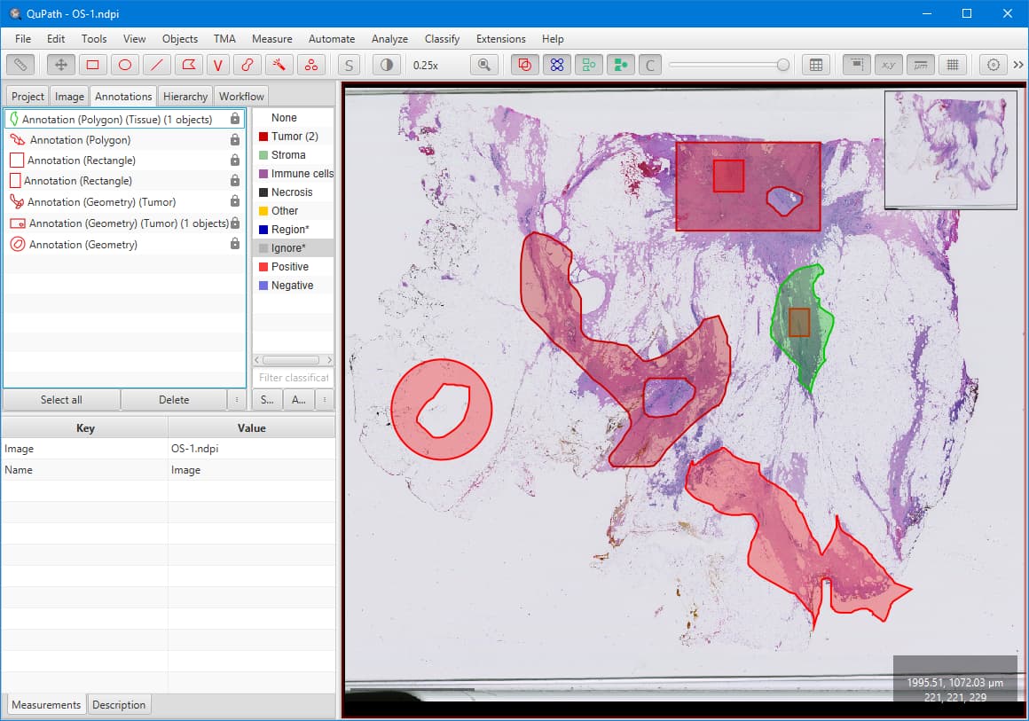 Python script to migrate Visiopharm ROI annotations to QuPath - Development - Image.sc Forum