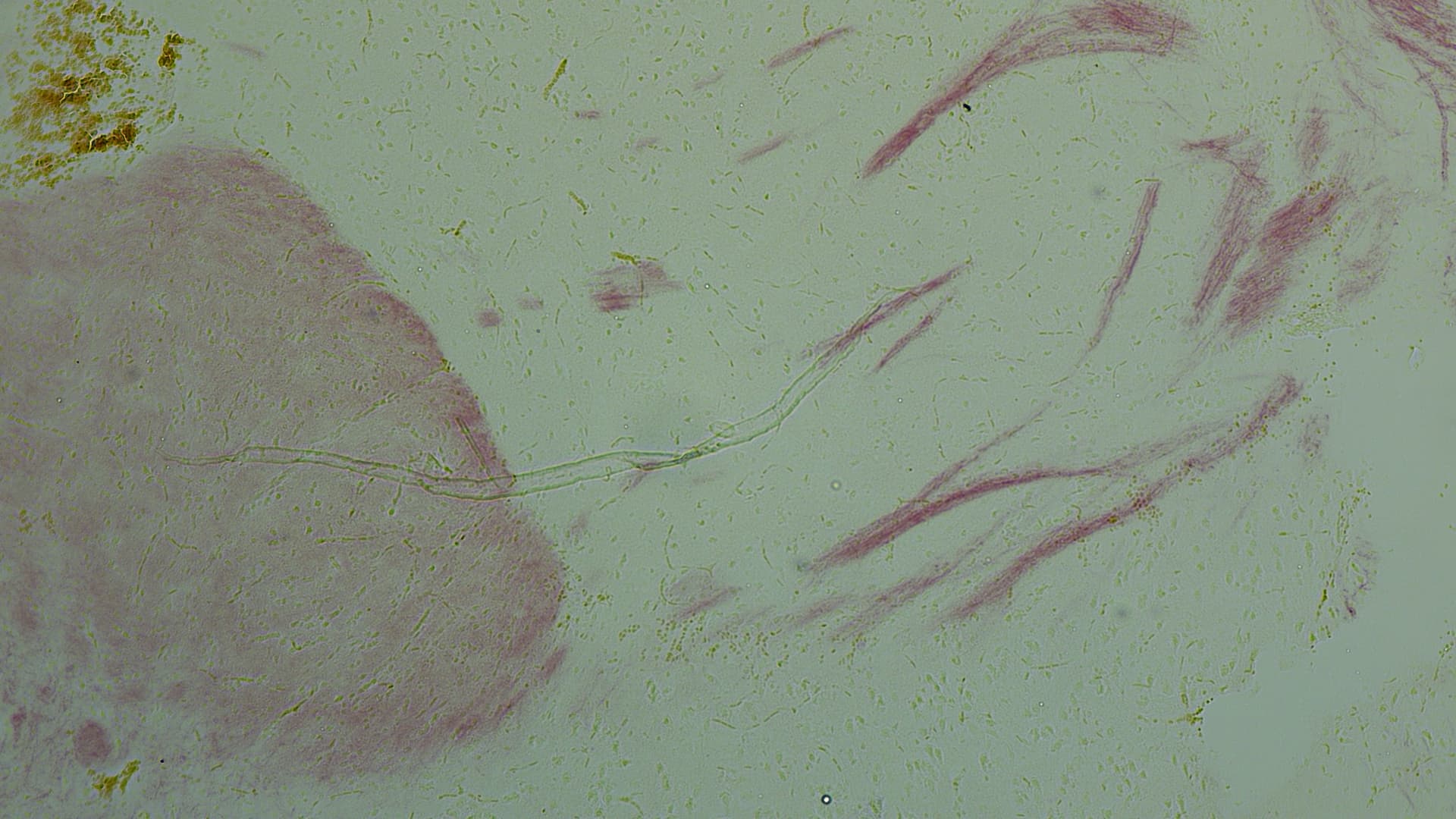 Image Analysis (Exporting Histogram Data from an Image Sequence) ImageJ ...