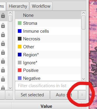 Assign a new class to annotation expansion in QuPath - Usage & Issues - Image.sc Forum