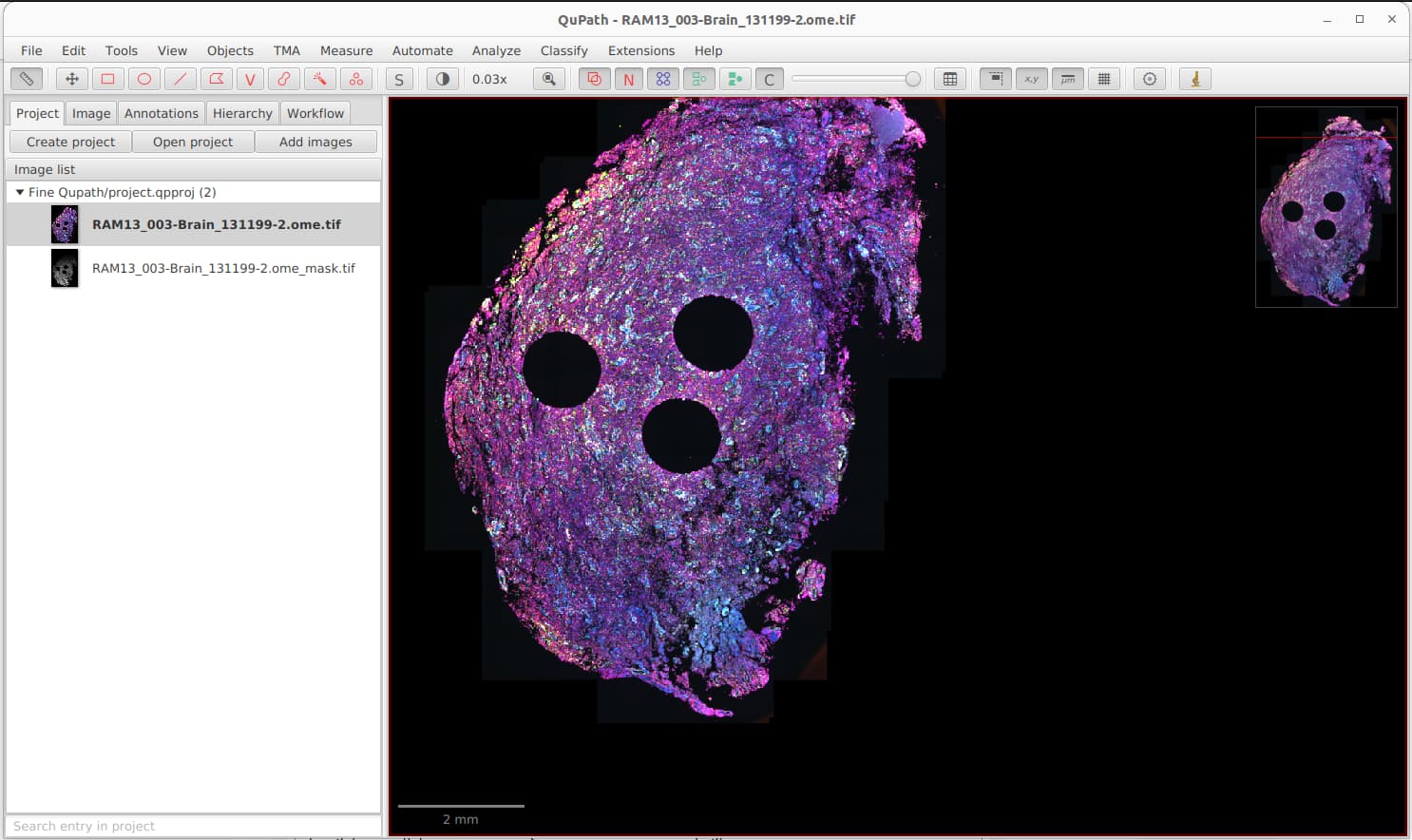 Topographic Analysis in QuPath - Image Analysis - Image.sc Forum