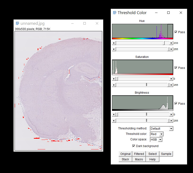 Set the right threshold - Usage & Issues - Image.sc Forum
