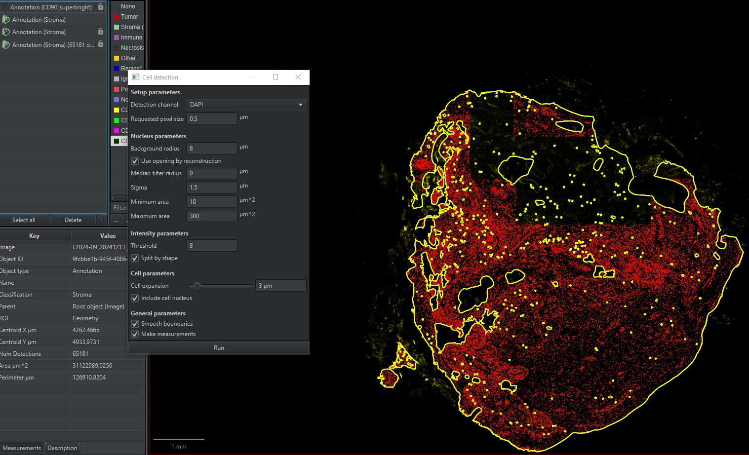 Cell Detection Not On Full Annotation In Qupath Image Analysis