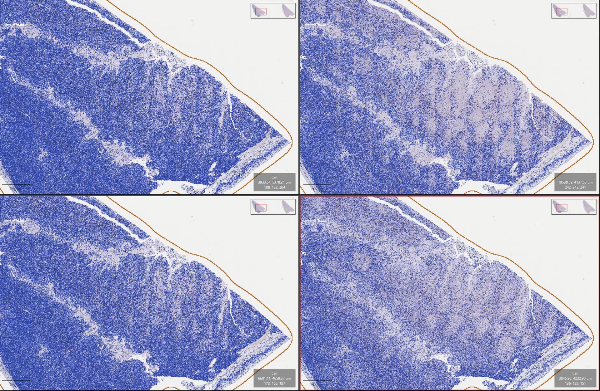 Cellpose Extension In Qupath - Cannot get deconvolution and normalization working together ...