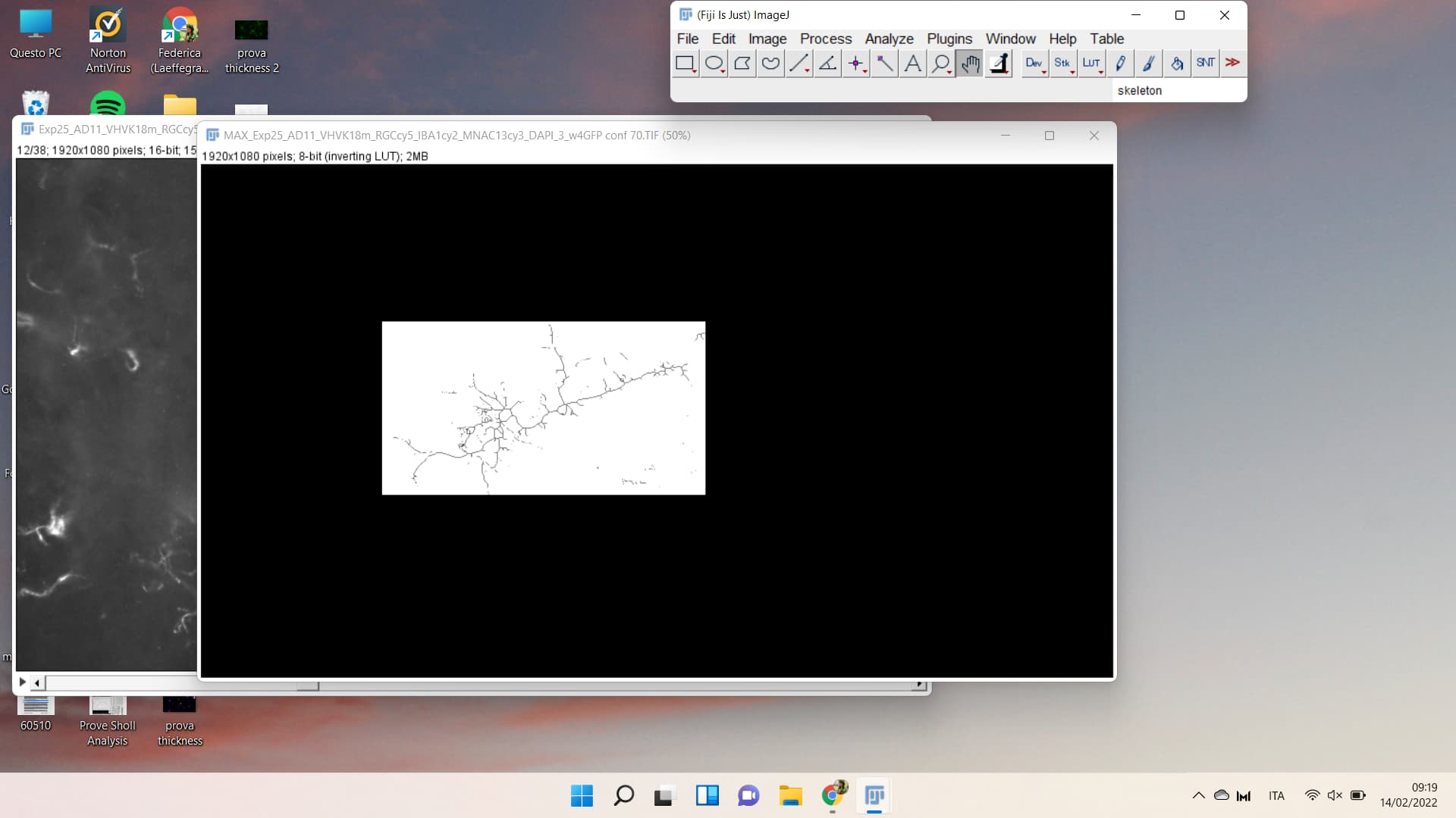 Analyze Skeleton 2D/3D: Performance and other issues - Image Analysis - Image.sc Forum