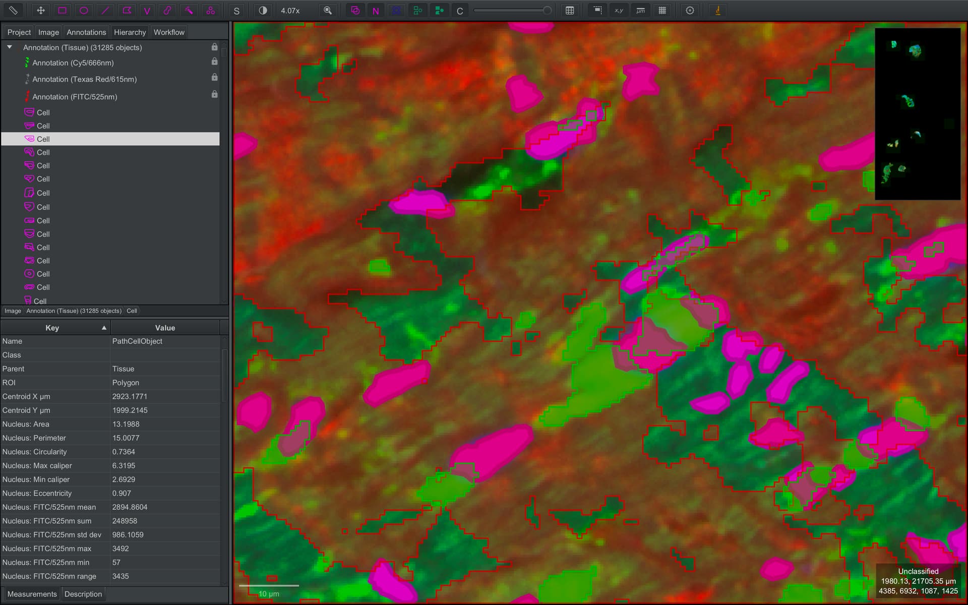 Multiple pixel classifiers for exclusive classes - Image Analysis - Image.sc Forum