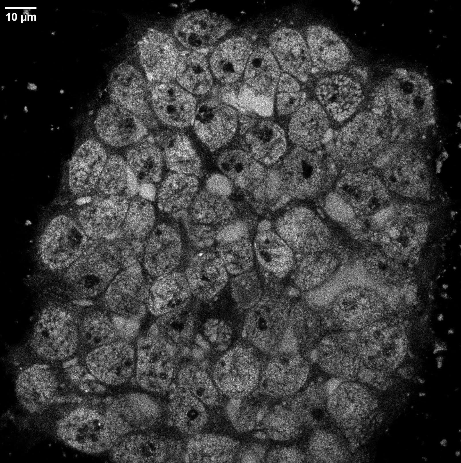 Segmenting Densely Packed Nuclei in 3D - Image Analysis - Image.sc Forum