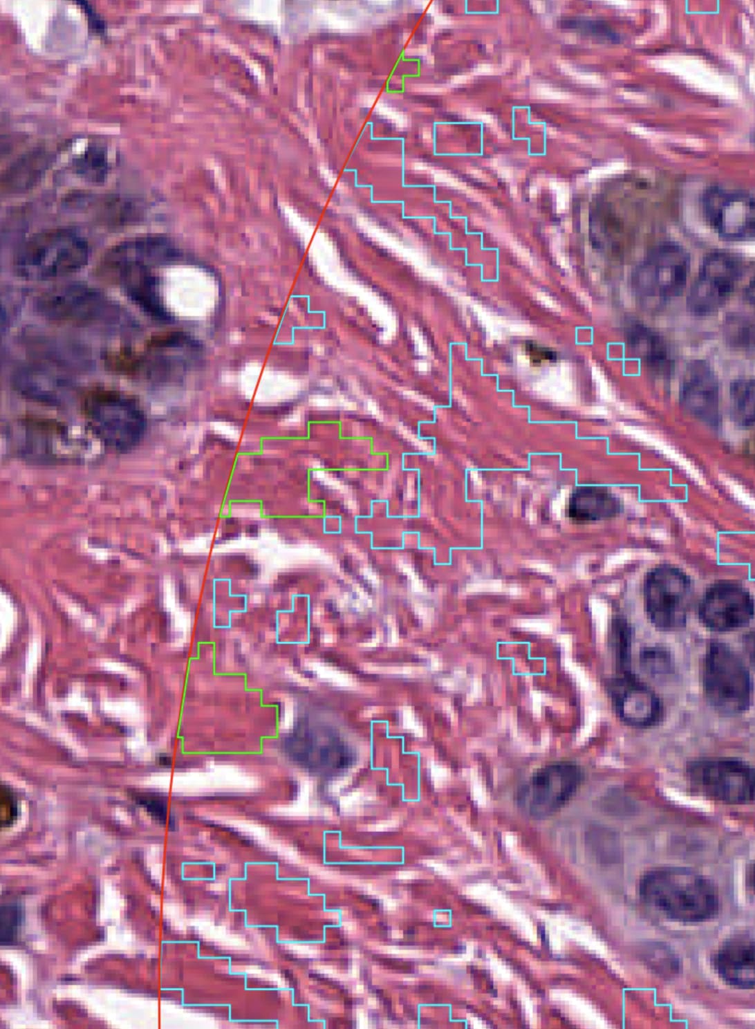 Inconsistency in annotation hierarchy resolution - Usage & Issues - Image.sc Forum