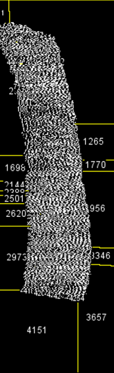Imagej Inconsistency Usage And Issues Image Sc Forum