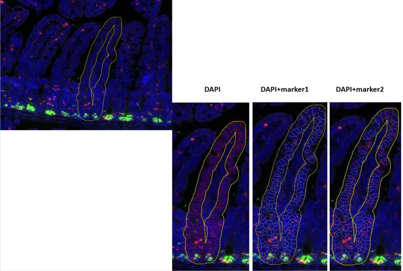 Detecting double positive cells in triple-stained fluorescent slides ...