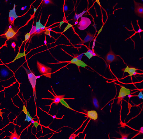 Segmenting neurons and other cells - Image Analysis - Image.sc Forum