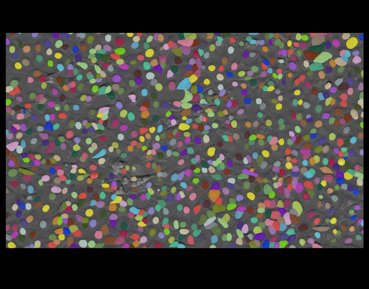 Segmenting cell image from CD7 microscope - Image Analysis - Image.sc Forum