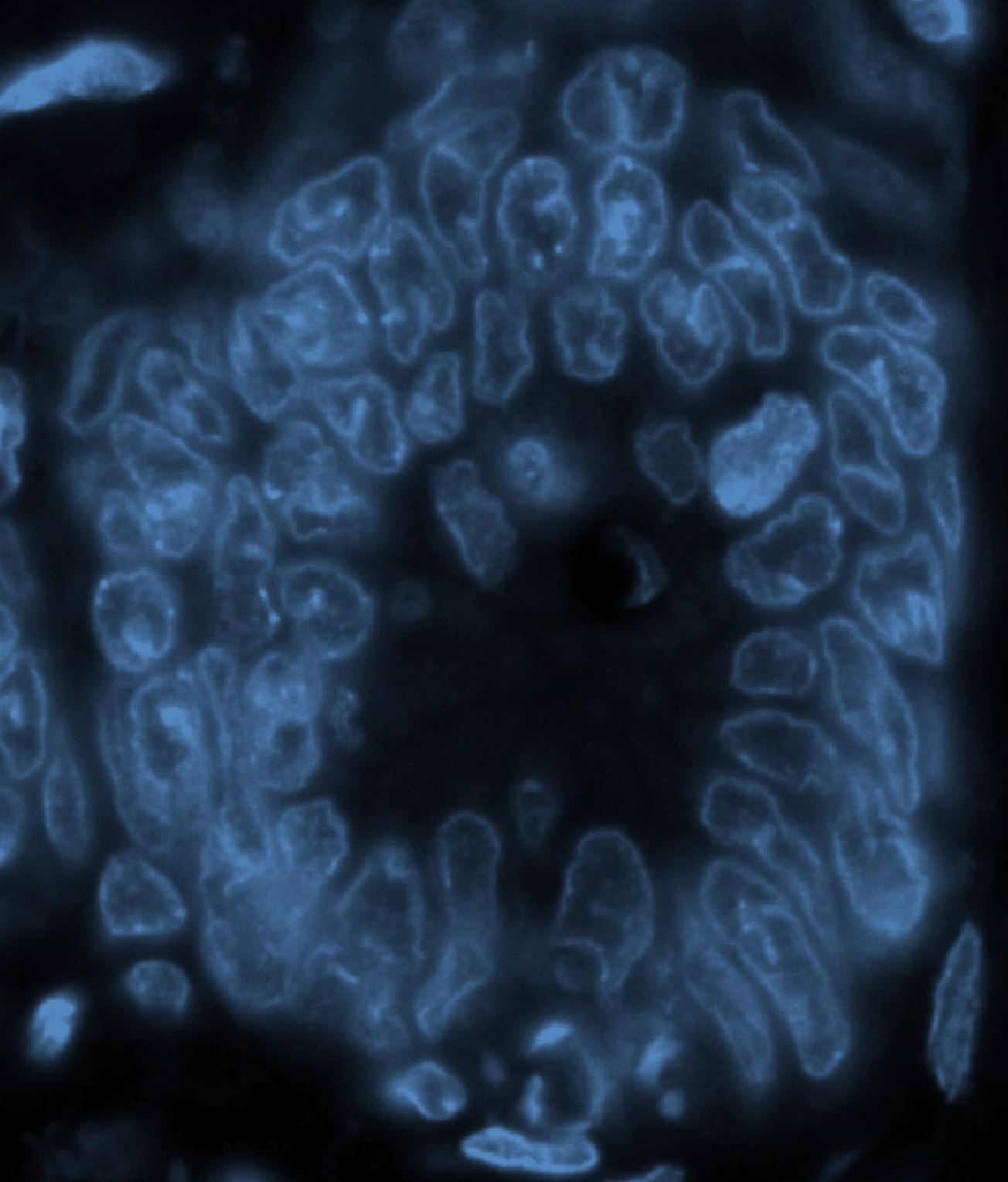 Tough Cell Segmentation - Image Analysis - Image.sc Forum